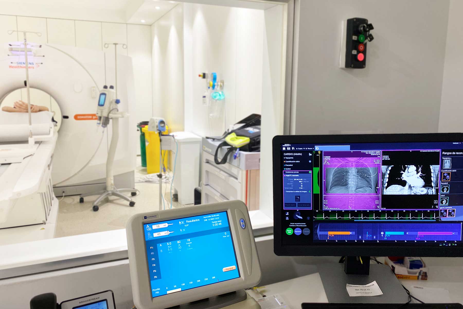 Angiology and Vascular Surgery - HC Marbella | HC Marbella ...