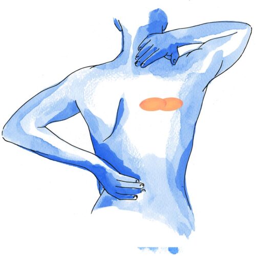 Herpes Zóster - HC Marbella | HC Marbella International Hospital